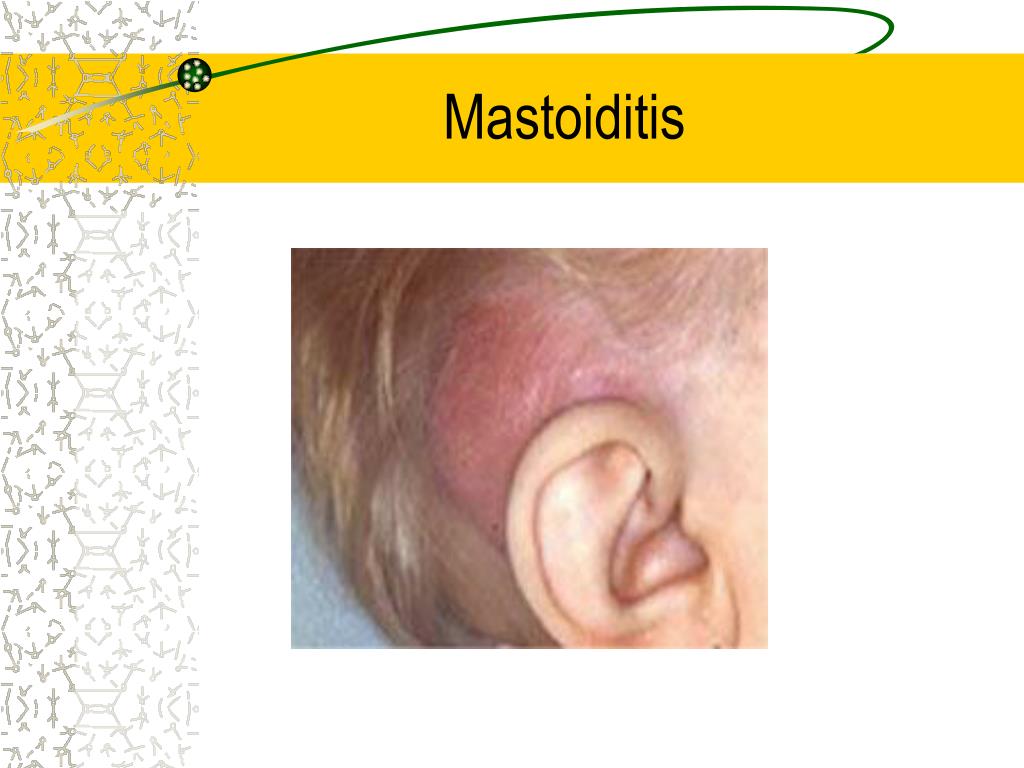 PPT - Nursing Care of the Pediatric Individual with a Respiratory ...