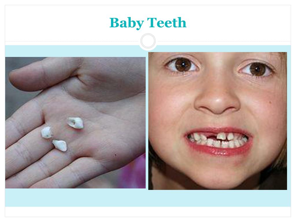 PPT - You Can Make a Positive Impact on a Child’s Oral Health ...