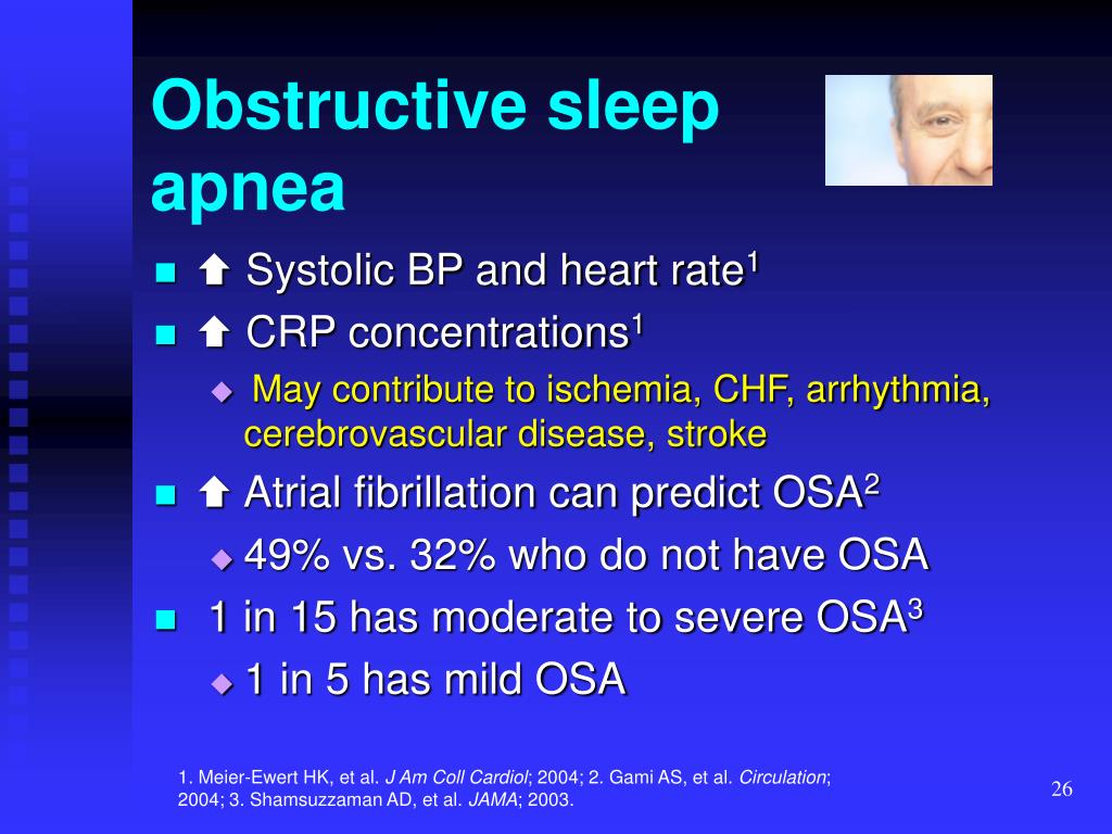 PPT - Differential Diagnosis and Treatment of Excessive Daytime ...