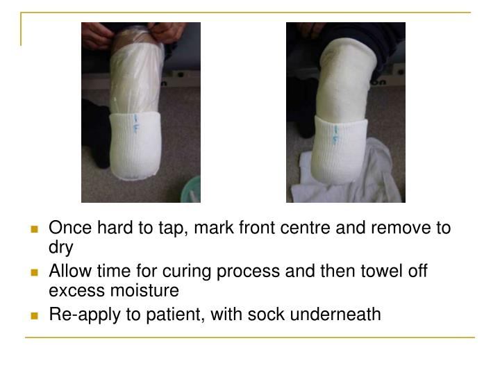 PPT - REMOVABLE RIGID DRESSING PowerPoint Presentation - ID:1818787