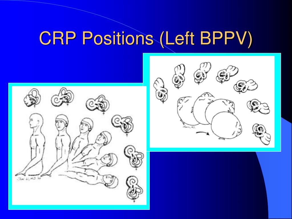 PPT - Clinical Evaluation of the Vertiginous Patient PowerPoint ...