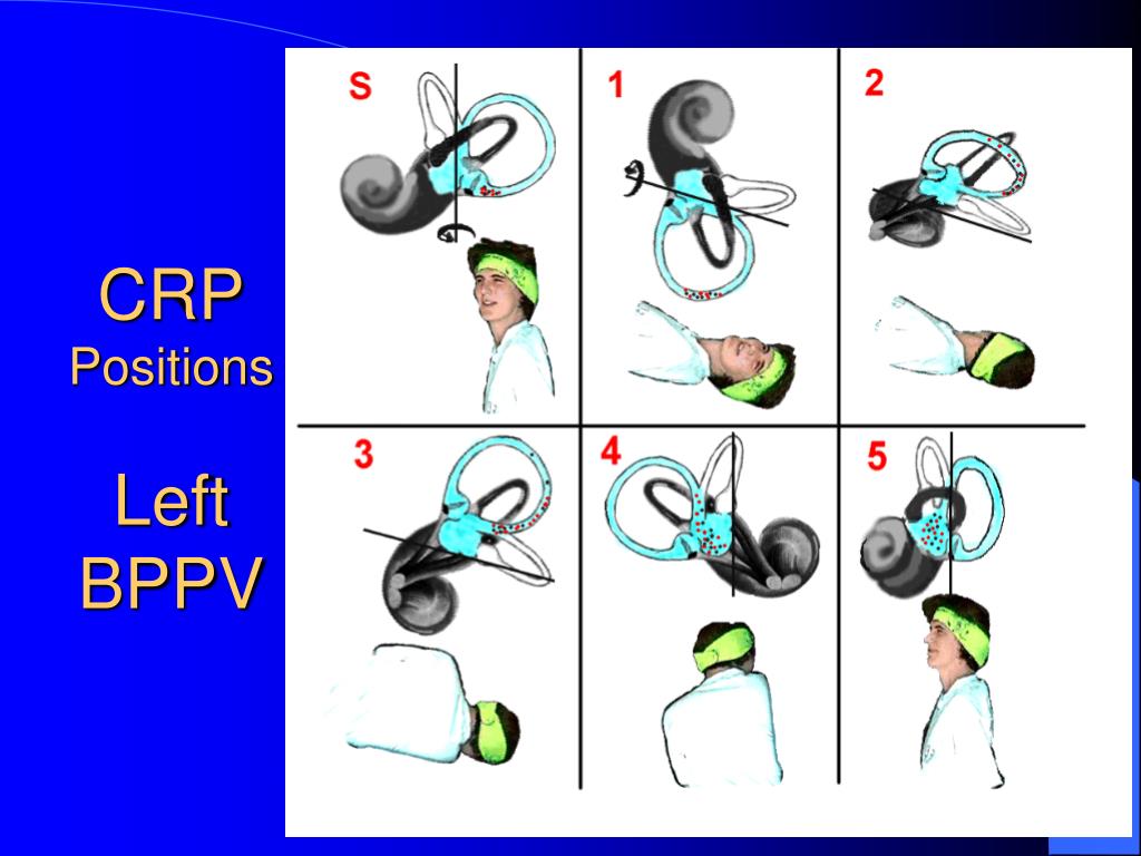 PPT - Clinical Evaluation of the Vertiginous Patient PowerPoint ...