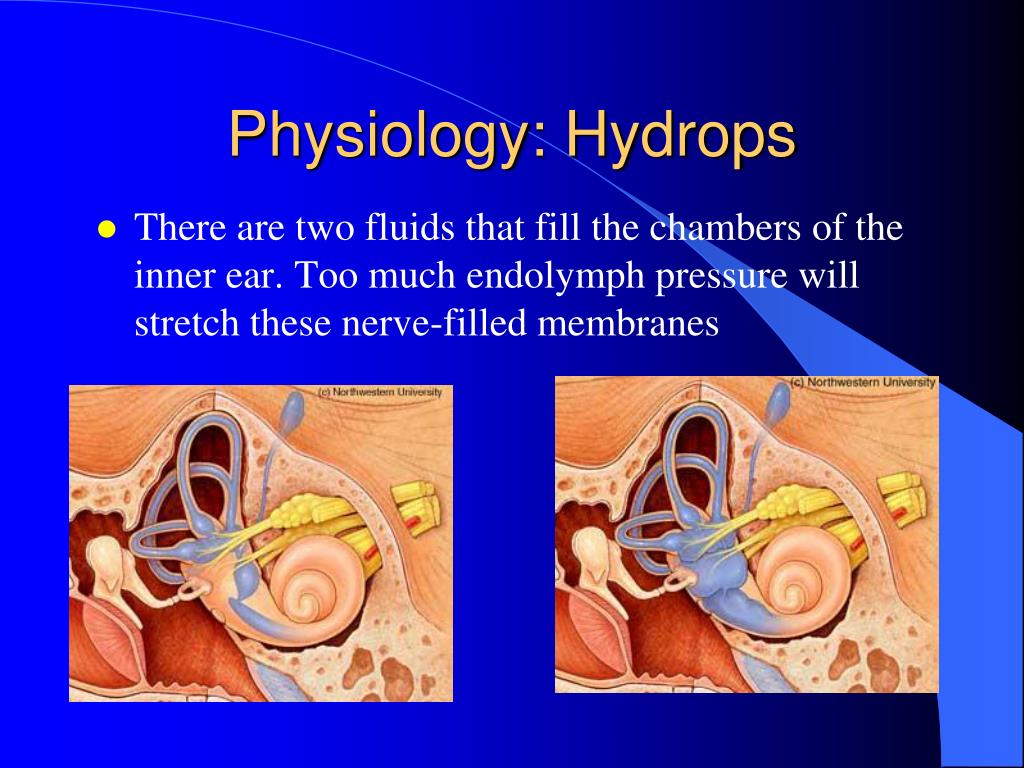 PPT - Clinical Evaluation of the Vertiginous Patient PowerPoint ...