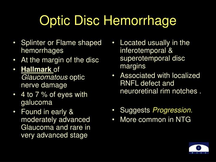 Ppt Optic Disc Evaluation In Glaucoma Powerpoint Presentation Id1823673