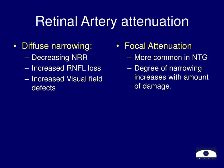 PPT - Optic Disc Evaluation IN Glaucoma PowerPoint Presentation - ID ...