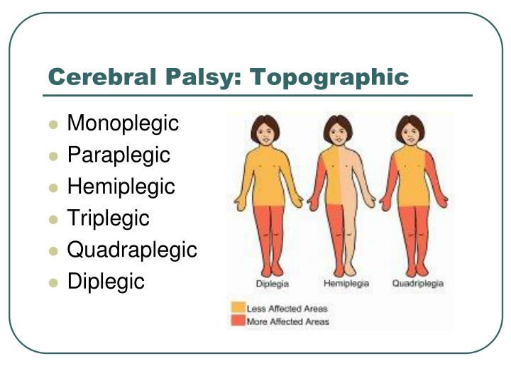 PPT - Cerebral Palsy = Brain Paralysis PowerPoint Presentation - ID:1824169