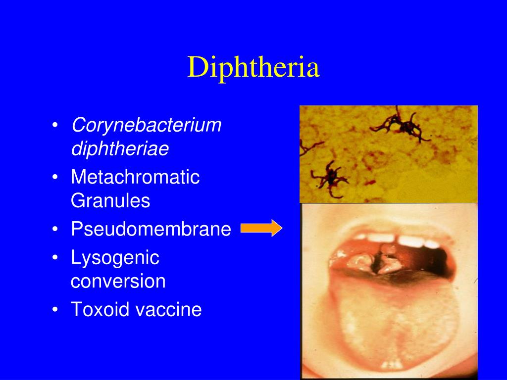 PPT - Person-to-Person Microbial Diseases PowerPoint Presentation, free ...