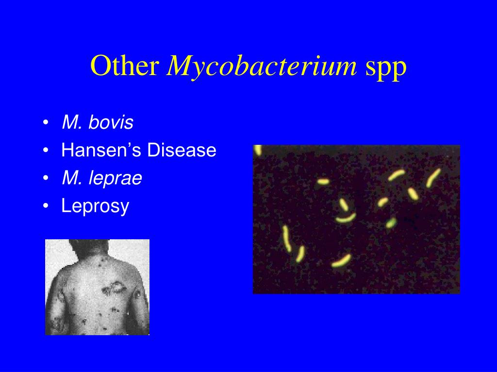PPT - Person-to-Person Microbial Diseases PowerPoint Presentation, free ...