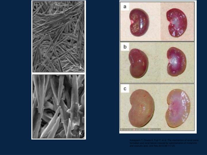PPT - Melamine contamination: the short- and long-term impacts on ...