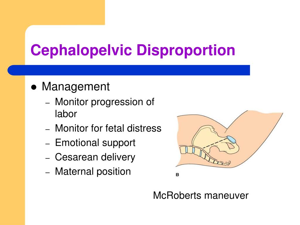 PPT - Childbirth at Risk: Labor Complications PowerPoint Presentation ...