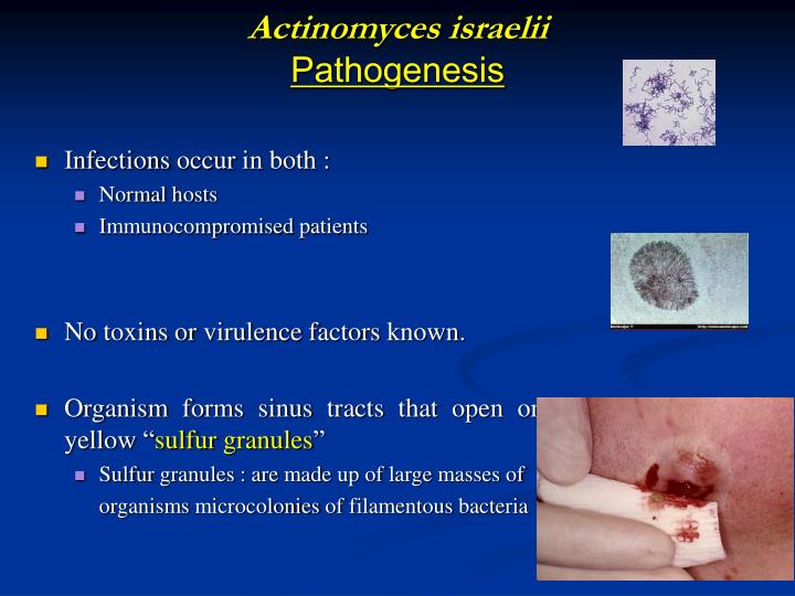 PPT - Mycoplasmas and Actinomycetes PowerPoint Presentation - ID:1826819