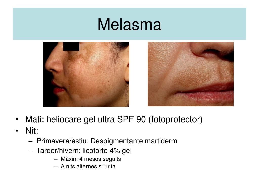 PPT - Dermatologia a atenció primària PowerPoint Presentation, free ...