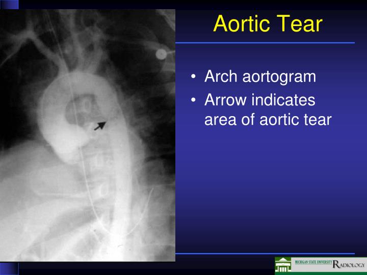 PPT - Soft Tissue Trauma PowerPoint Presentation - ID:1827932