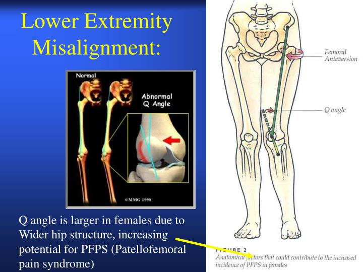 PPT - Muscles and Movements of Lower Extremity – Ch 8 Objectives ...