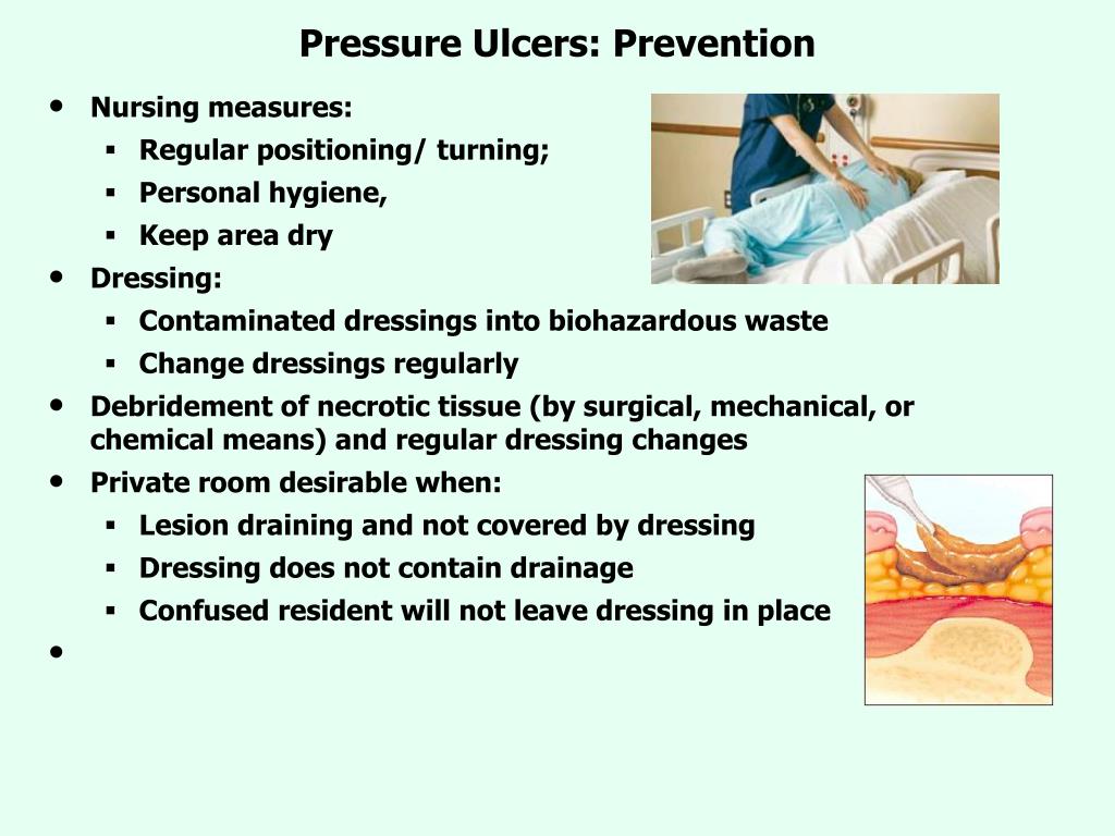 PPT - Elderly Patient: Common Infections PowerPoint Presentation, free ...