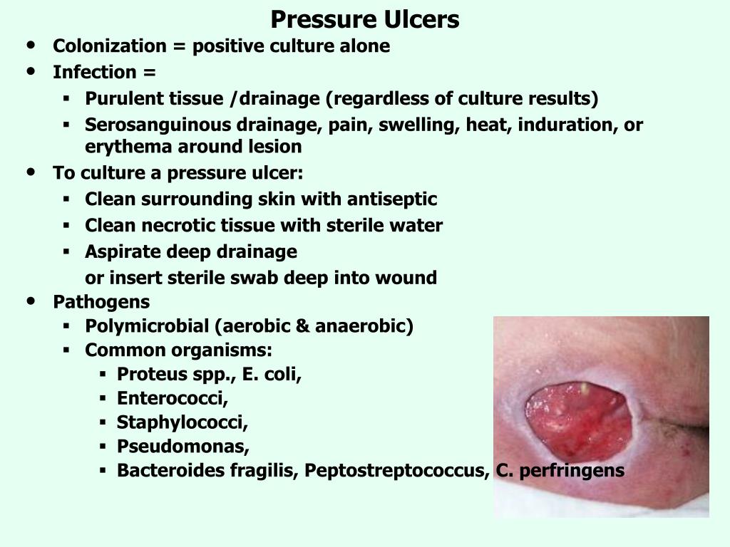 PPT - Elderly Patient: Common Infections PowerPoint Presentation, free ...