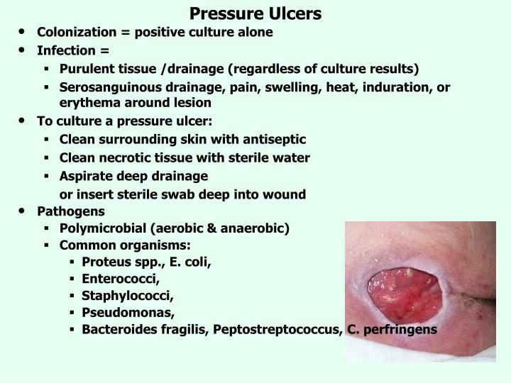 PPT - Elderly Patient: Common Infections PowerPoint Presentation - ID ...