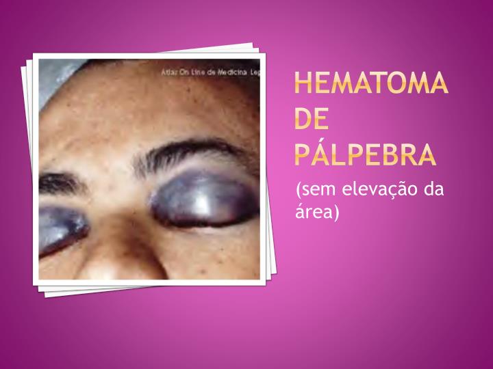 PPT - Traumatologia Forense PowerPoint Presentation - ID:1838863