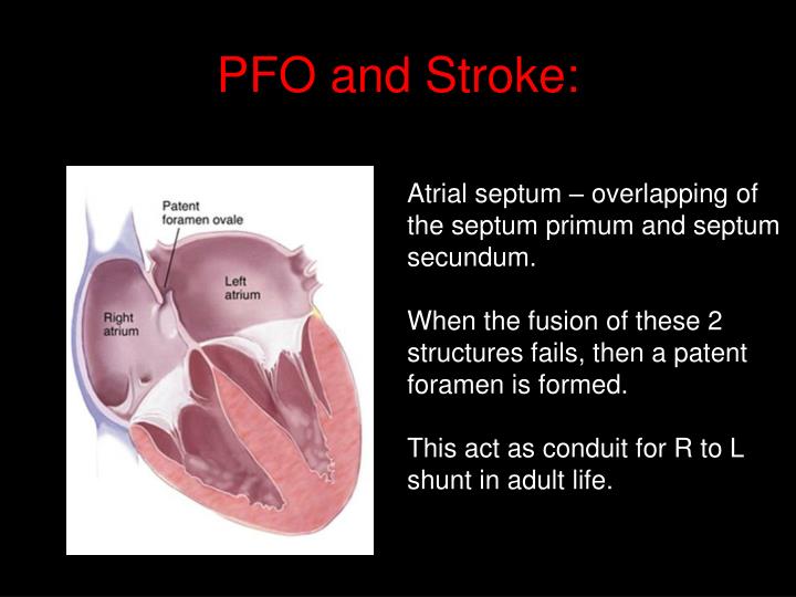 PPT - UBC-Case 1 PowerPoint Presentation - ID:1842065