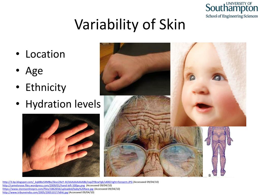 PPT - Some Aspects of Skin Tribology : Friction Blister PowerPoint ...