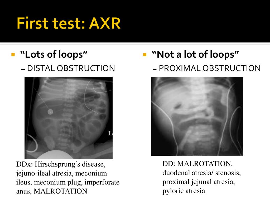 PPT - Pediatric Surgery for the Pediatric Board Review PowerPoint ...