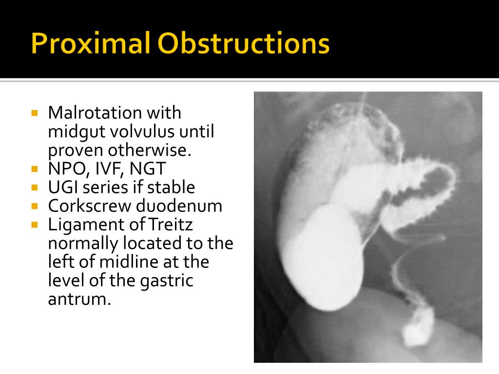 PPT - Pediatric Surgery for the Pediatric Board Review PowerPoint ...