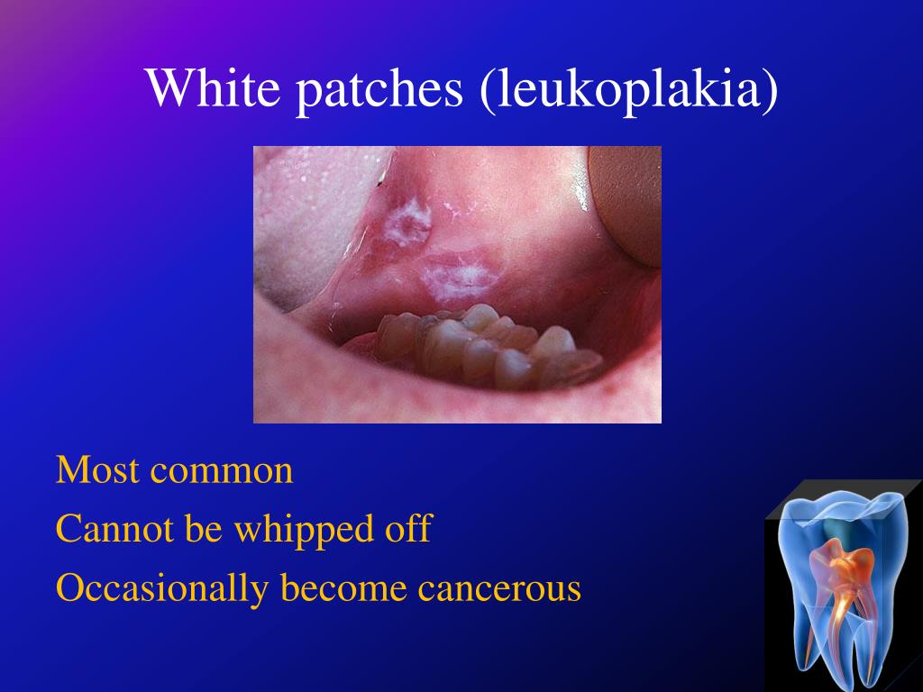 PPT - Welcome Home. Welcome to Oral Health. PowerPoint Presentation ...