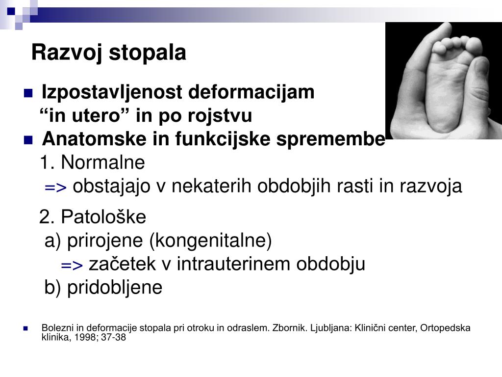 PPT - Razvoj stopala in nepravilnosti stopal v otroštvu PowerPoint ...