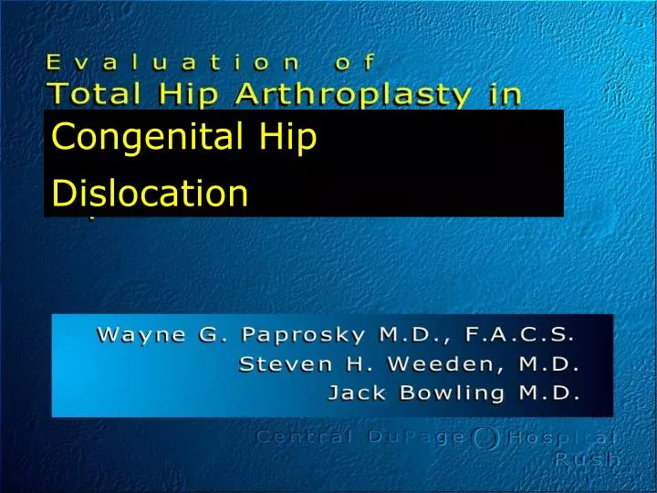 Ppt Congenital Hip Dislocation Powerpoint Presentation Free Download 5376