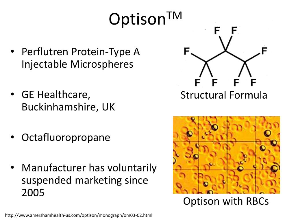 PPT - Ultrasound Imaging (Contrast Agents and Therapy) BIOE 498/598 DP ...