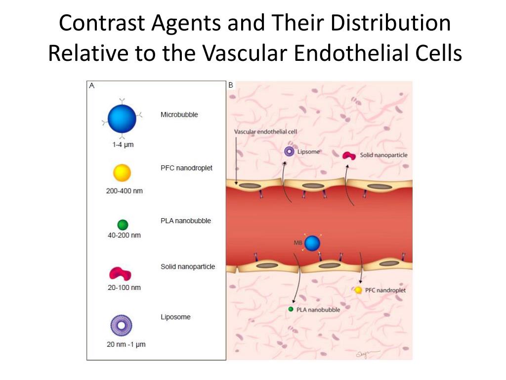 PPT - Ultrasound Imaging (Contrast Agents and Therapy) BIOE 498/598 DP ...