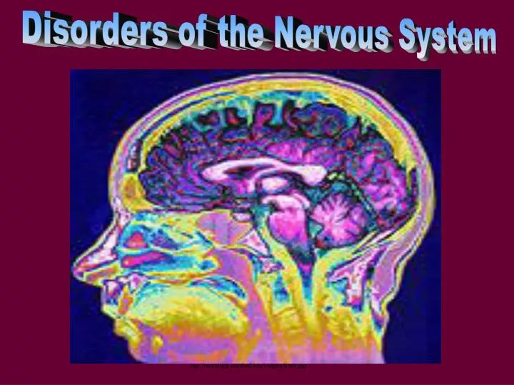 PPT - Disorders of the Nervous System PowerPoint Presentation, free download - ID:1847980
