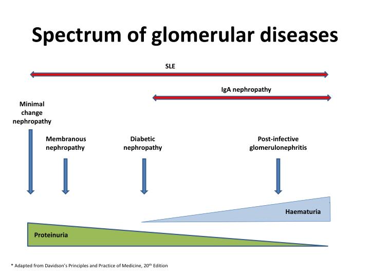 PPT - Glomerular Diseases PowerPoint Presentation - ID:1847996