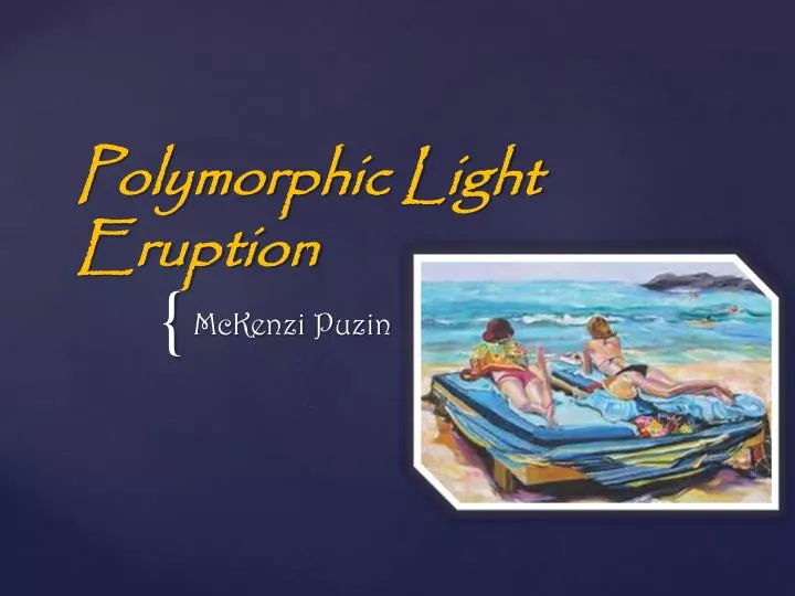 PPT - Polymorphic Light Eruption PowerPoint Presentation, free download ...