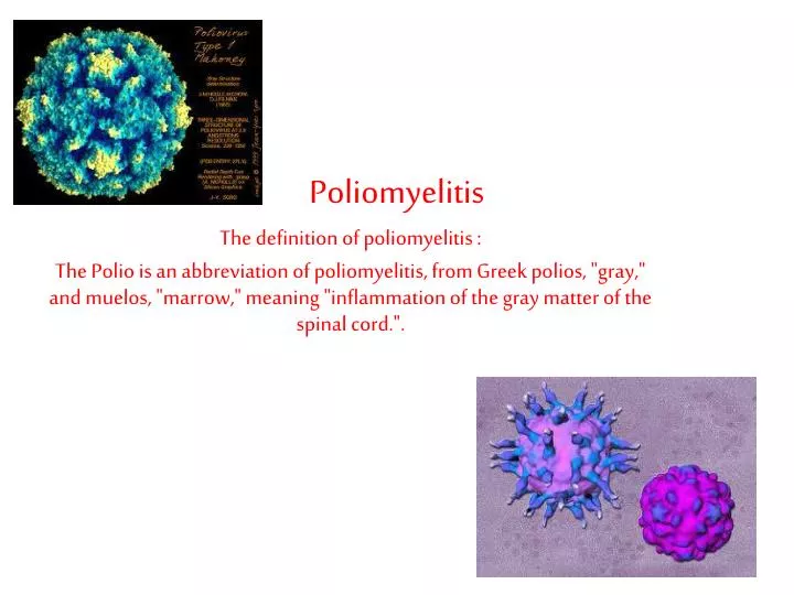 PPT - Poliomyelitis PowerPoint Presentation, free download - ID:1848142