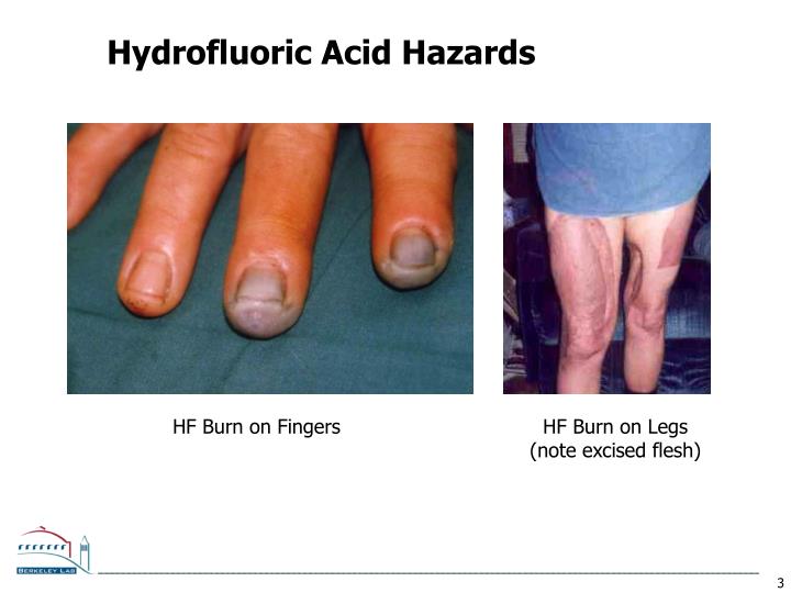 PPT - Hydrofluoric Acid SAFETY PowerPoint Presentation - ID:1848460