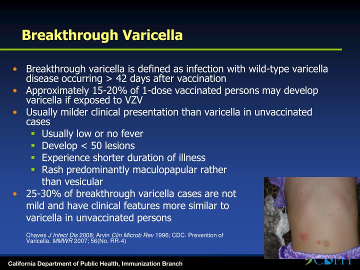 PPT - Varicella (Chickenpox) and Herpes Zoster (Shingles) PowerPoint ...