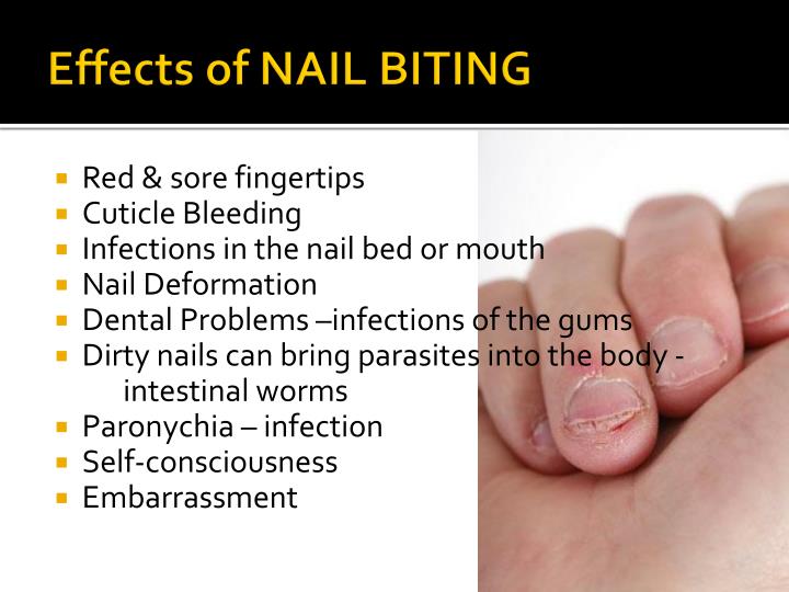 PPT - NAIL BITING PowerPoint Presentation - ID:1851297