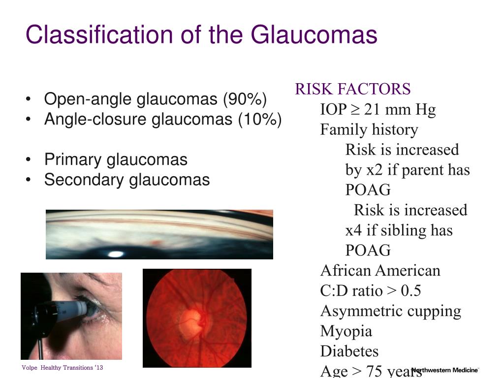 PPT - Nicholas J. Volpe, MD Tarry Professor and Chairman Department of ...