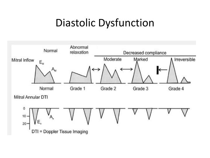 PPT - TISSUE DOPPLER IMAGING PowerPoint Presentation - ID:1855797