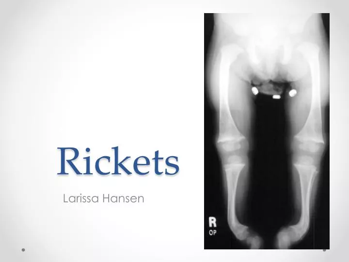 PPT - Rickets PowerPoint Presentation, free download - ID:1857345