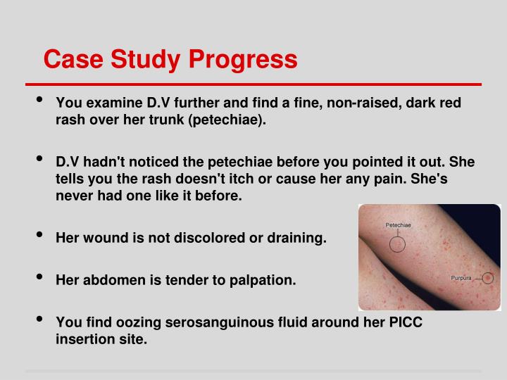 PPT - DIC Disseminated Intravascular Coagulation PowerPoint ...