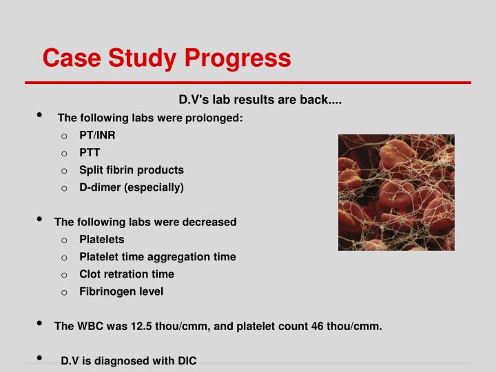 PPT - DIC Disseminated Intravascular Coagulation PowerPoint ...