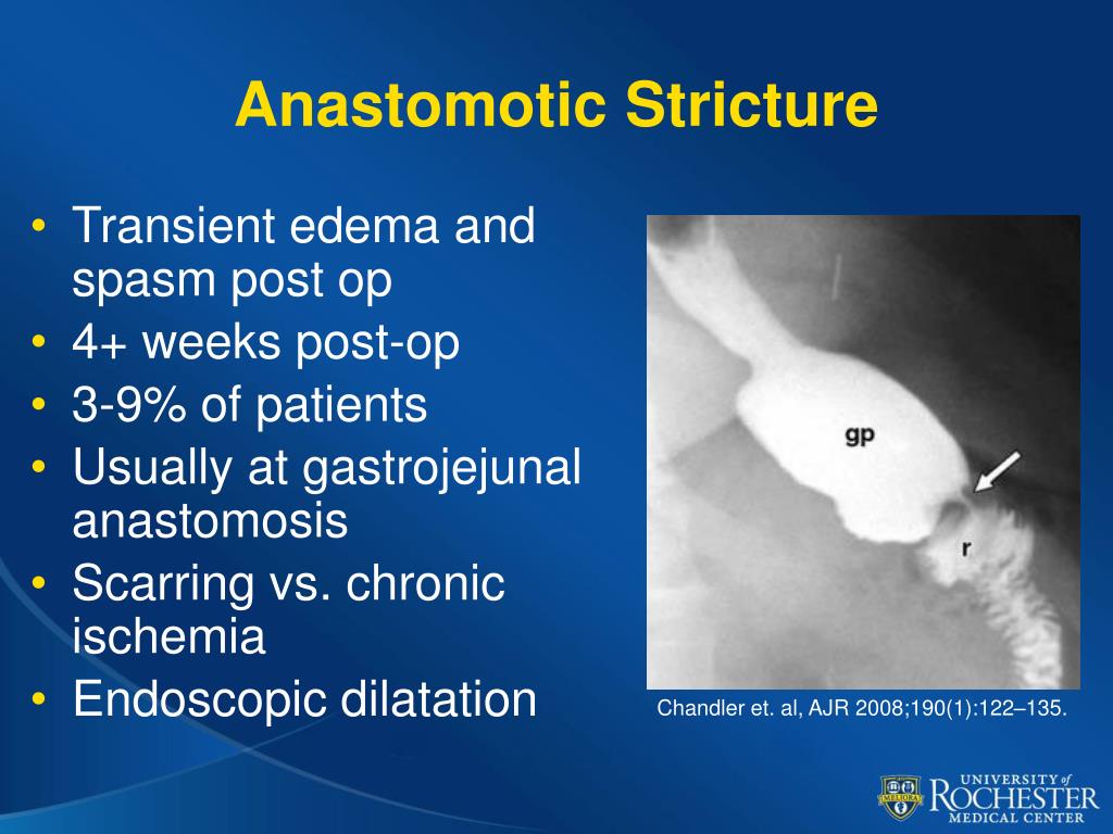 PPT - Imaging of Bariatric Surgery: Normal Anatomy and Postoperative ...