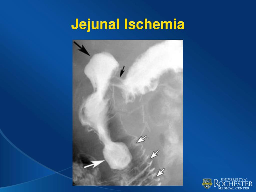 PPT - Imaging of Bariatric Surgery: Normal Anatomy and Postoperative ...