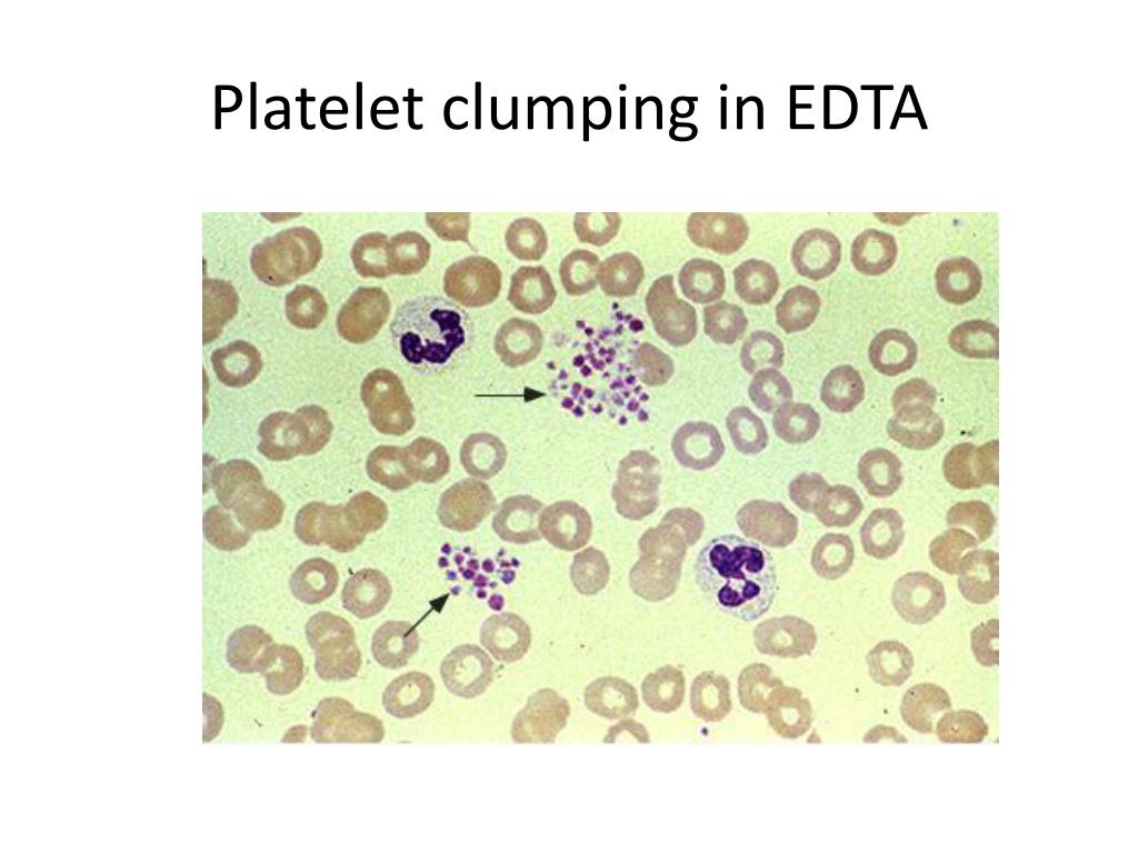 What Is Platelet Clumping