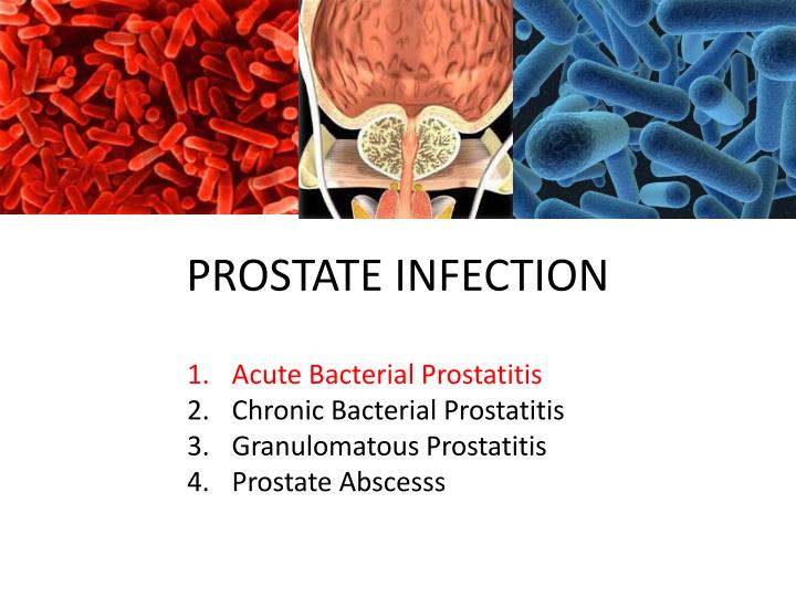 PPT - PROSTATE INFECTION PowerPoint Presentation - ID:1862350