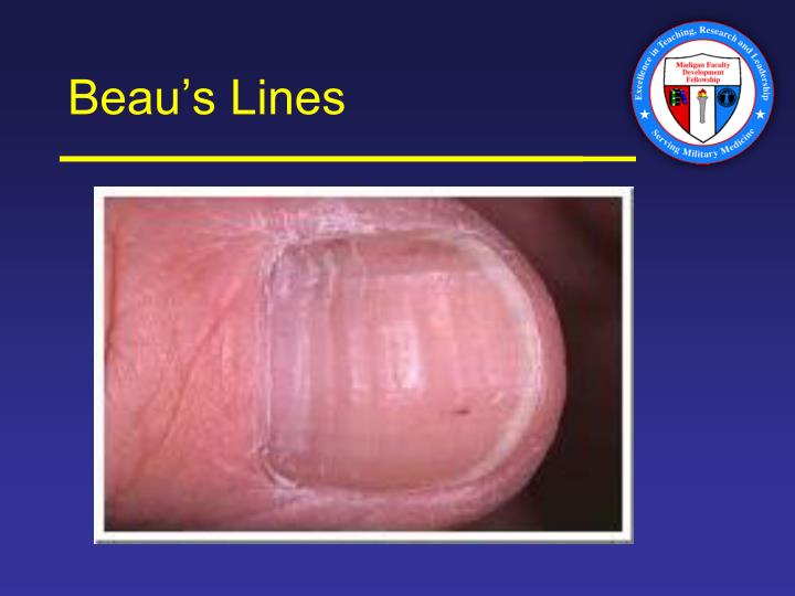 PPT - Is it Only Skin Deep? Dermatologic Evidence of Systemic Disease ...
