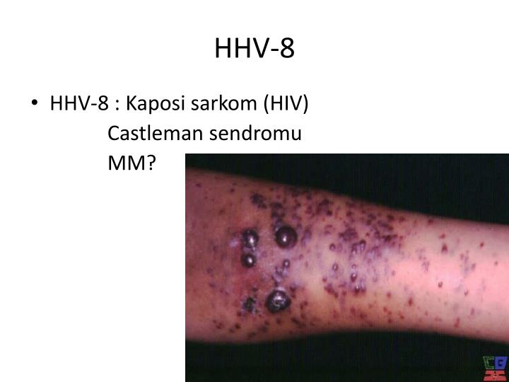 PPT - Herpesviruslar-1 PowerPoint Presentation - ID:1862623