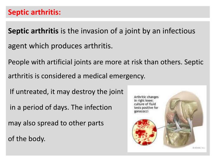 PPT - Infectious Myositis: PowerPoint Presentation - ID:1865298